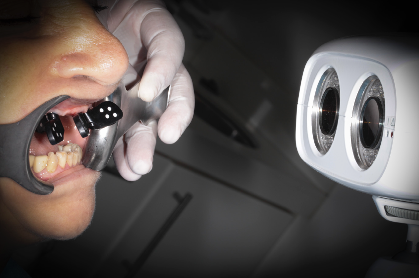 An in vivo prospective comparative study: Accuracy of complete‐arch digital implant impression ...